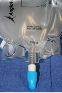 Drainage Catheter Care - Radiology Associates of Atlanta : Radiology ...